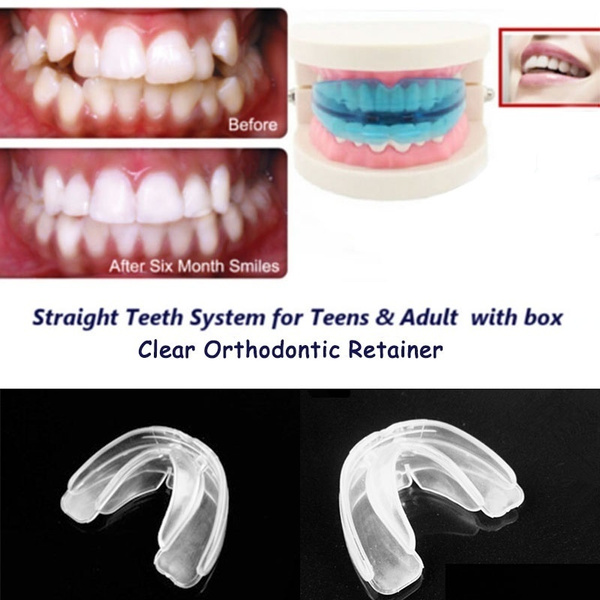 Straight Teeth System Retainer and Box | Wish