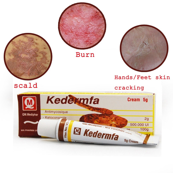 5g Vietnam Kedermfa Pure Snake Ointment For Burn Scald Skin Cracking ...