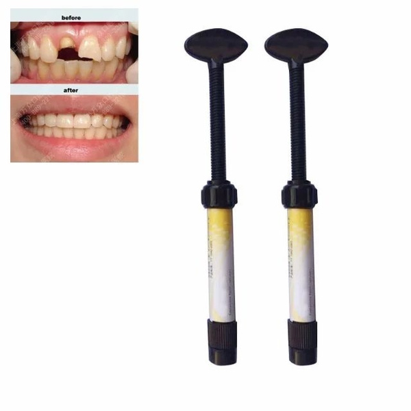 Dental 2X Temporary Light Cure Filling material Composite Resin | Wish