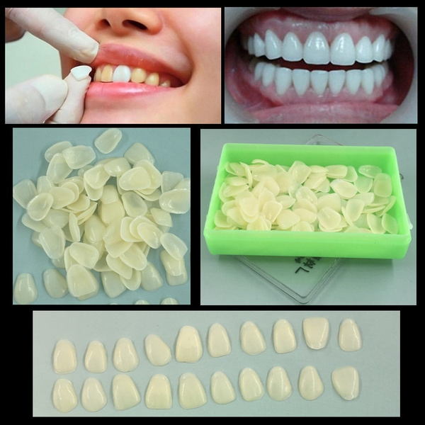 New Dental Ultra-Thin Whiting Veneers Resin Teeth Upper Anterior Shade ...
