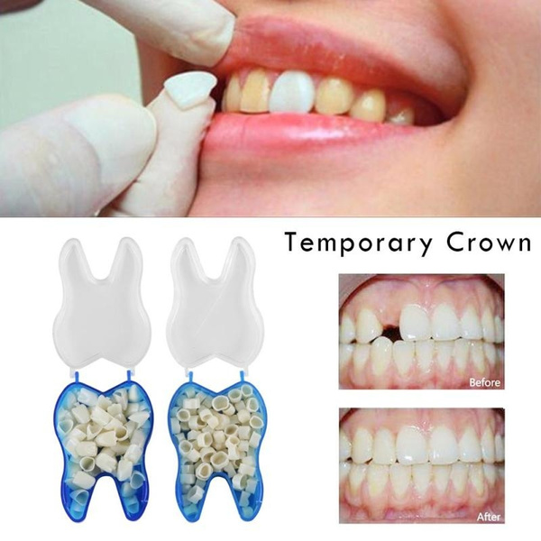 50 pcs/Box Resin Porcelain Materials Temporary Oral Anterior Molar ...