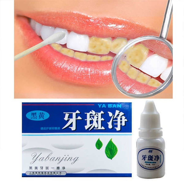 Quick Effect to Yellow Dental Plaque Dental Tattoo Black Stained ...