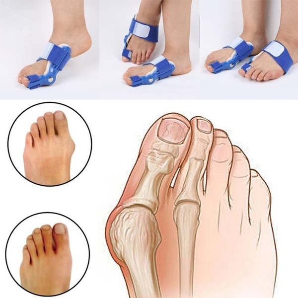 1 Pc Day Night Bunion Splint Big Toes Corrector Hallux Valgus ...