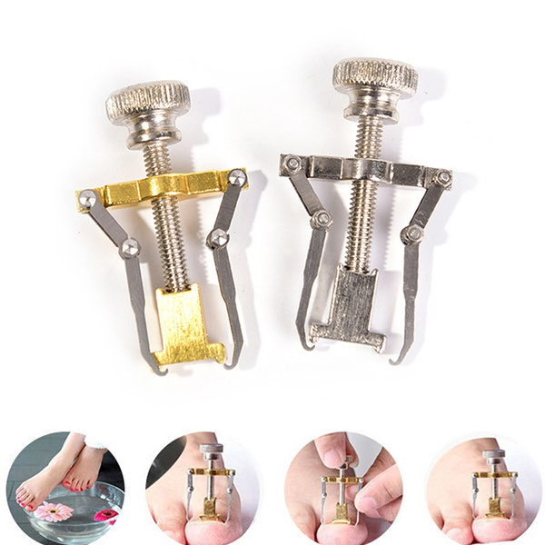 Professional Ingrown Toe Nail Correction Pedicure Fixed Nail Art ...