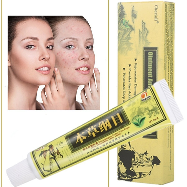 Natural Chinese Herbal Psoriasis Treatment Eczema Cream for Dermatitis ...