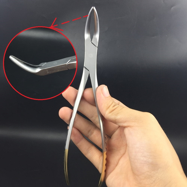 Dental Root Fragment Minimal Invasive mandibular Tooth Extraction ...