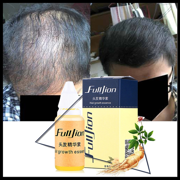 FULLJION hair growth liquid hair essence 20ml thick long hair ...