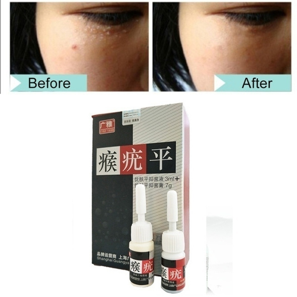 2pcs/pack Verruca Treatment Essence Set Rich In Herbal Antibacterial ...