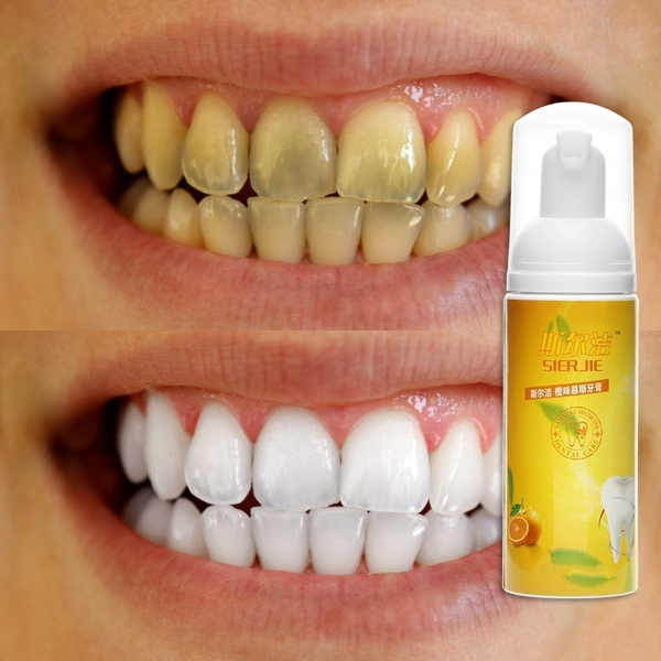 Tooth Whitening Teeth Whitening Mouth Cleaning Liquid Oral Hygiene ...