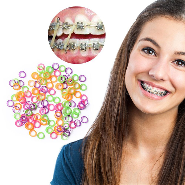 100pcs New Dental Orthodontic Rubber Bands Latex Braces Transparent ...