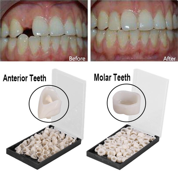 50Pcs/Box 2Types Dental Teeth Temporary Realistic Oral Care Anterior ...