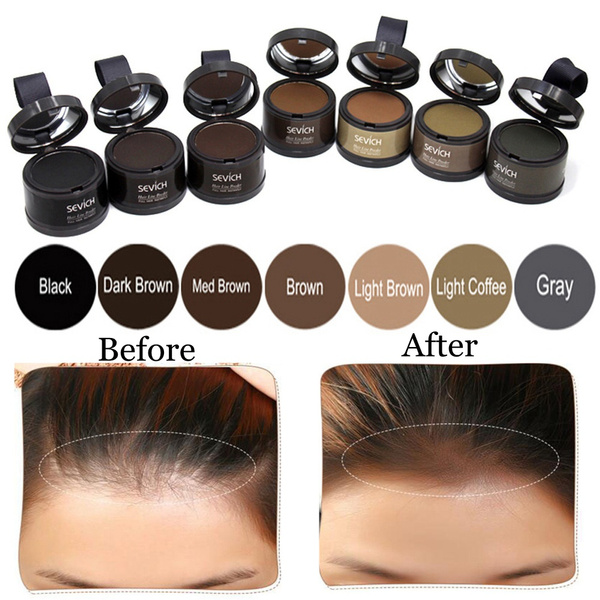 1PC Bald Coverage Concealer Hair Fluffy Hairline Repair Hair Filling ...