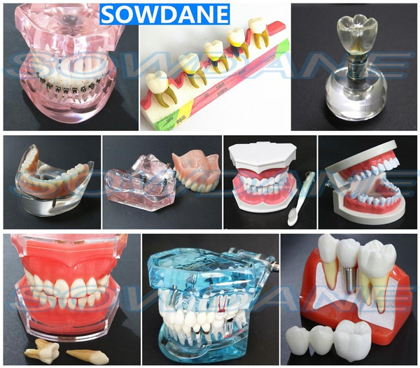 1 piece Dental Model Overdenture Model Orthodontic Model for Patient ...