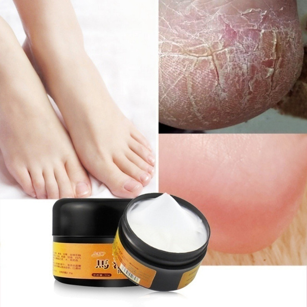 NEW Horse Oil Foot Cream Anti-Chapping Skin Repairing Moisturizer for ...
