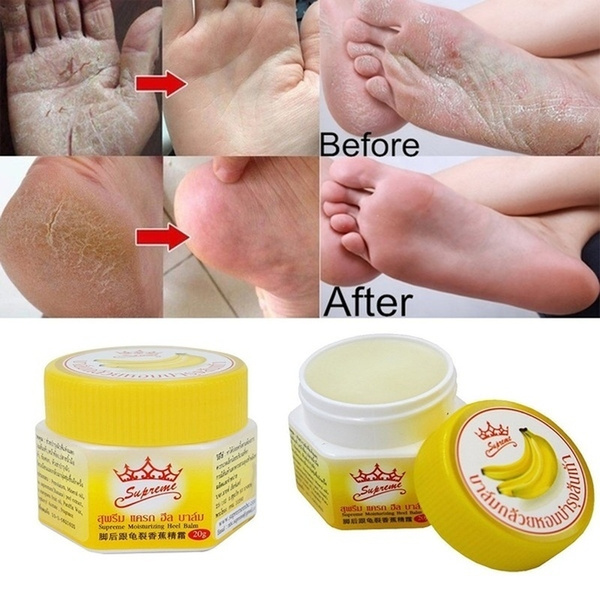 New Banana Oil Anti-cracking Cream Hand Heel Anti-fungal Anti-fracture ...