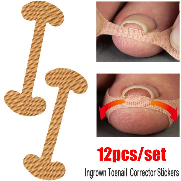 12 Pcs Ingrown Toenail Foot Corrector Stickers Toe Nail Care Pedicure ...