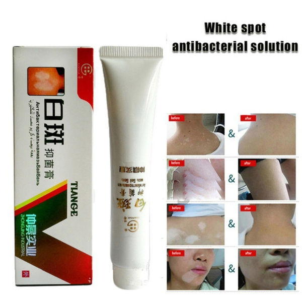 CHR Medical Antibacterial Melanin Promoting Liniment Chinese Herbal ...