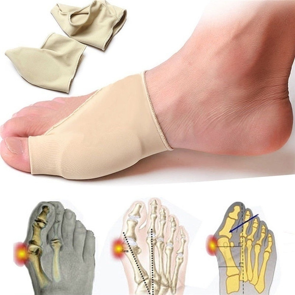 Hallux Valgus Correction Sleeve Feet Care Special Big Toe Bone Silicone ...