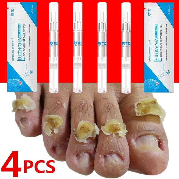 Newest 3ML Anti Fungal Nail Treatment Nail Pen Onychomycosis Paronychia ...