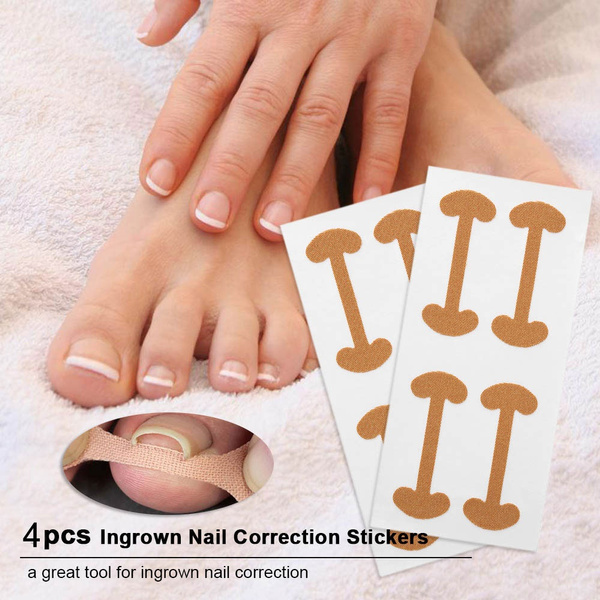 4Pcs/Set Professional Ingrown Toenail Correction Patch, Toenail Brace ...