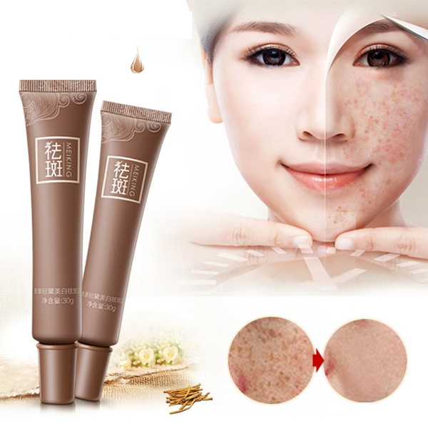 Women Dark Spot Corrector Skin Whitening Fade Face Cream Lightening Removal Serum Reduces Age ...