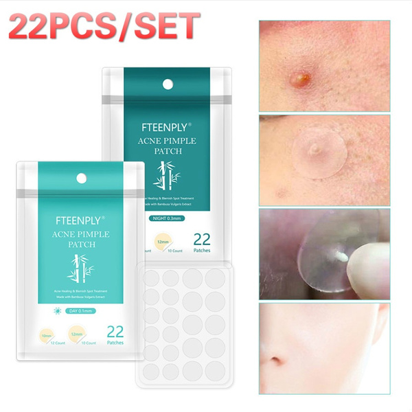 2020 NEW Acne Pimple Patch Acne Treatment Stickers Pimple Remover Tool ...