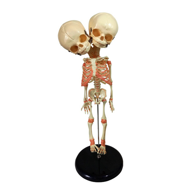 37CM Two-headed Skull Human Newborn Baby Double Head Anatomy Skull ...