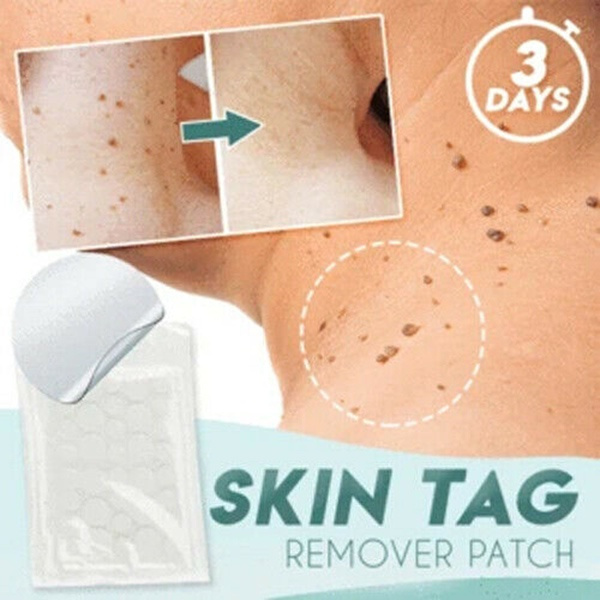 1/2/4 Pack Skin Tag and Acne Master Patch Sticker Face Facial Skin Care ...
