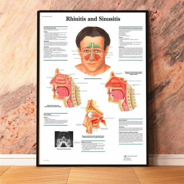 Frameless Anatomy Diseases Pathology Chart Canvas Painting Body Map ...