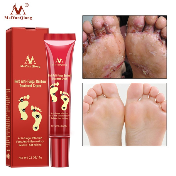 MeiYanQiong Herbal Effective Foot Treatment Anti Fungal Infection ...