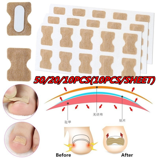 50/20/10 Pcs Toenail Deformation Corrector Glue-free Toe Nail Inlay ...