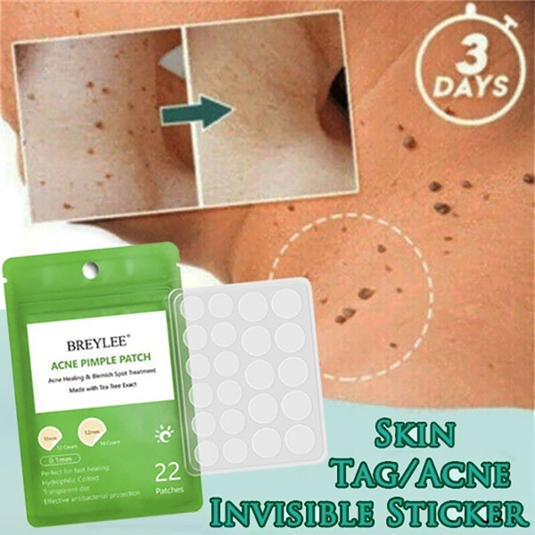 Invisible Acne Removal Patches Fast Absorb Acne Secretions Effectively ...