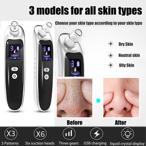 Charging Electric Blackhead Acne Cleaner Nose Face Facial Care Electric ...