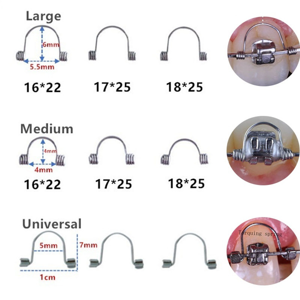 New Dental Orthodontic Torquing Spring Warran Spring 13 Size | Wish