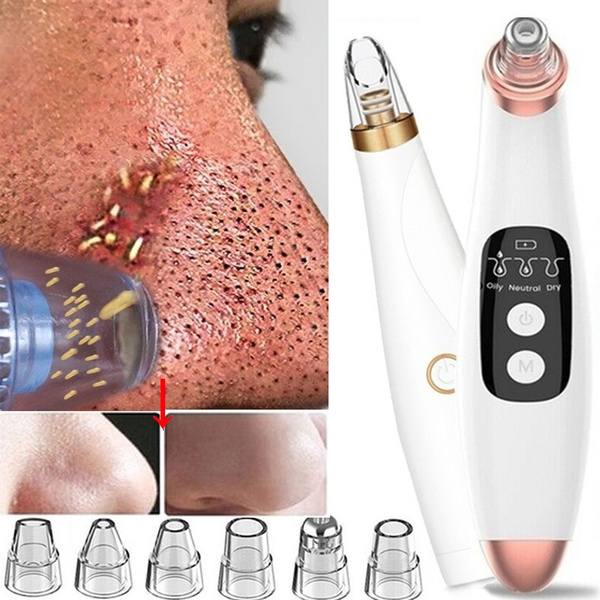 Blackhead Vacuum Remover Nose T Zone Pore Acne Pimple Removal Vacuum ...