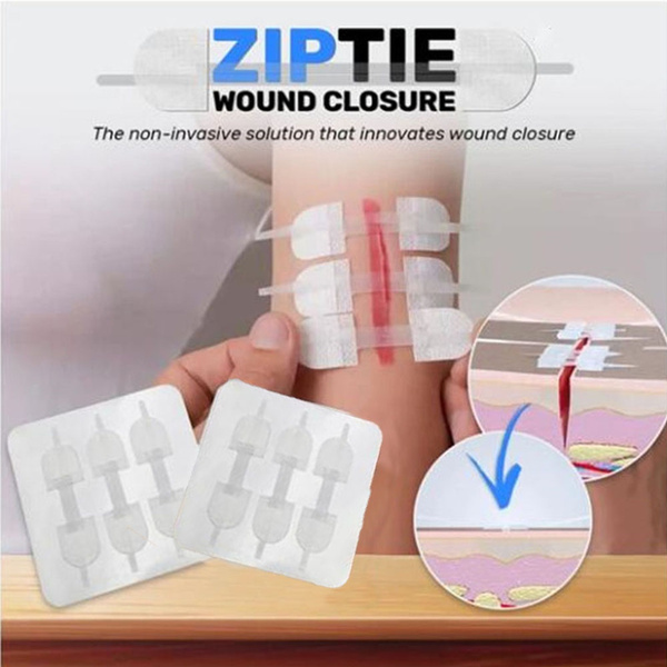 Disposable Outdoor Painless Laceration Patch Without Stitches Aid ...