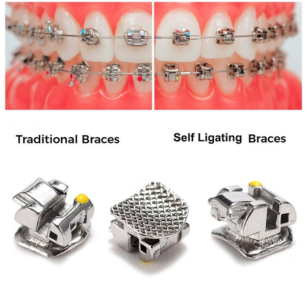 New 20Pcs/Kit Dental Orthodontic Self Ligating Brackets Braces With Bonding Adhesive | Wish