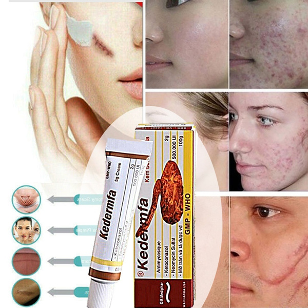 Snake Oil Remove Scar Cream Skin Care Pigmentation Corrector Face ...