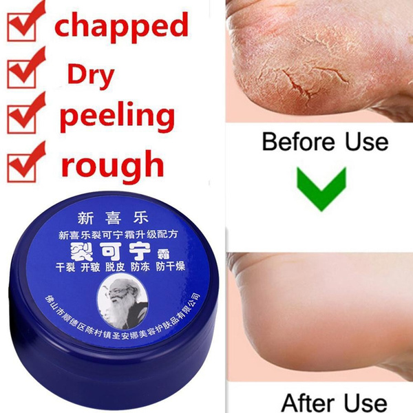 33g Hand Foot Crack Cream Anti Dry Chapped Cream Dry Skin Heel Chapped ...
