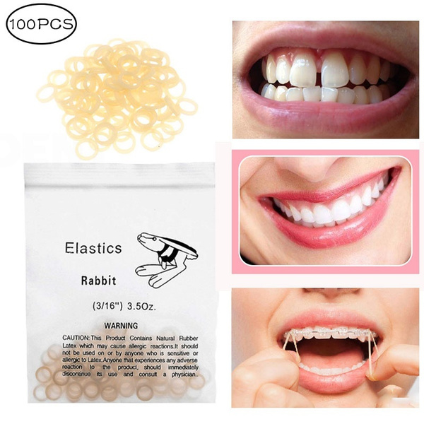 Health Teeth Gap Elastics 100pcs/bag Dental Oral Latex Braces ...