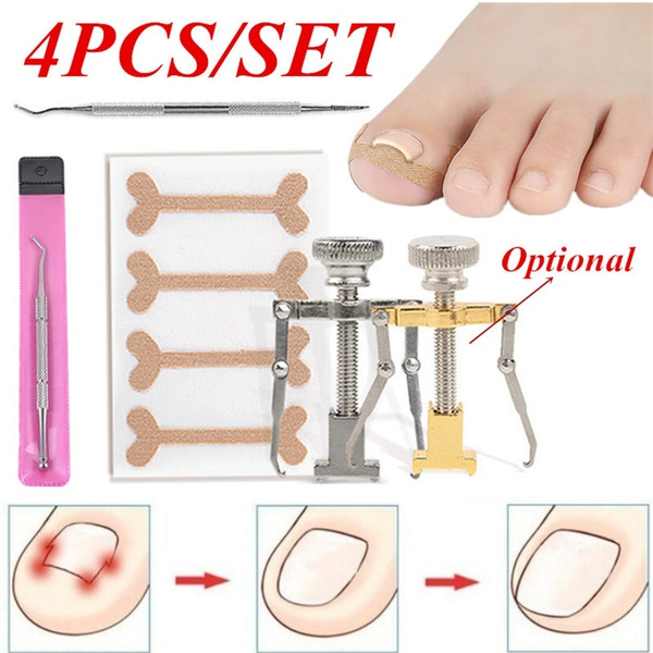 Professional 1 Set Pedicure Tool Paronychia Toenail Straightening ...