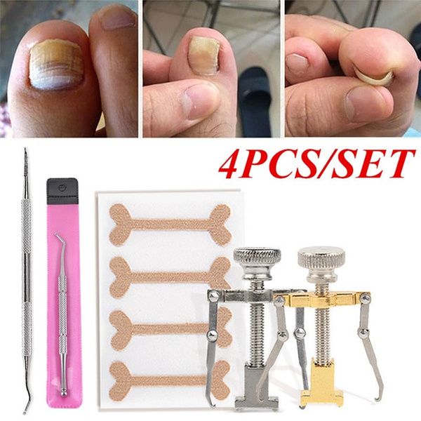 Professional 1 Set Toenail Straightening Pedicure Tool Paronychia Hook ...