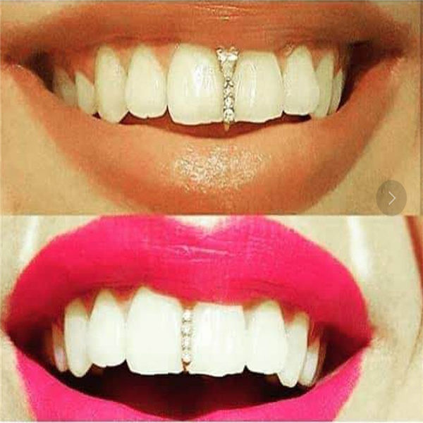 Hip Hop Teeth Crystal Top Grills Dental Mouth Punk Teeth Caps Cosplay ...