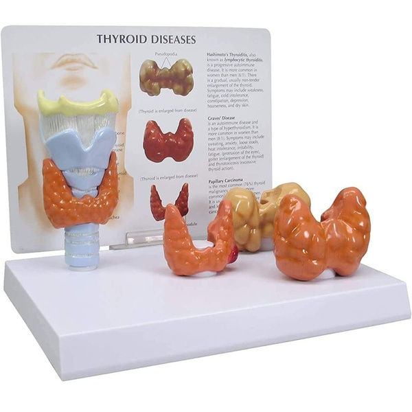 Thyroid Hyperthyroidism, Hypothyroidism, human endocrine system of ...