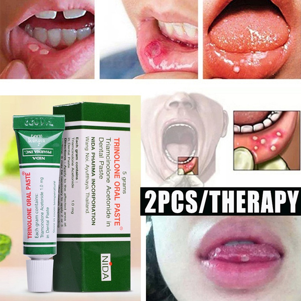 Mouth Ulcer Relief Gel Natural Herbal Oral Hygiene Antibacterial Cream ...