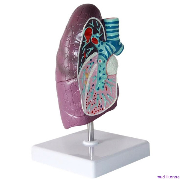 Human model respiratory Lung lesions Lung anatomy model of human ...