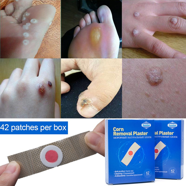 Medical Corn Remover Patch Foot Corn Removal Warts Thorn Patch Curative ...