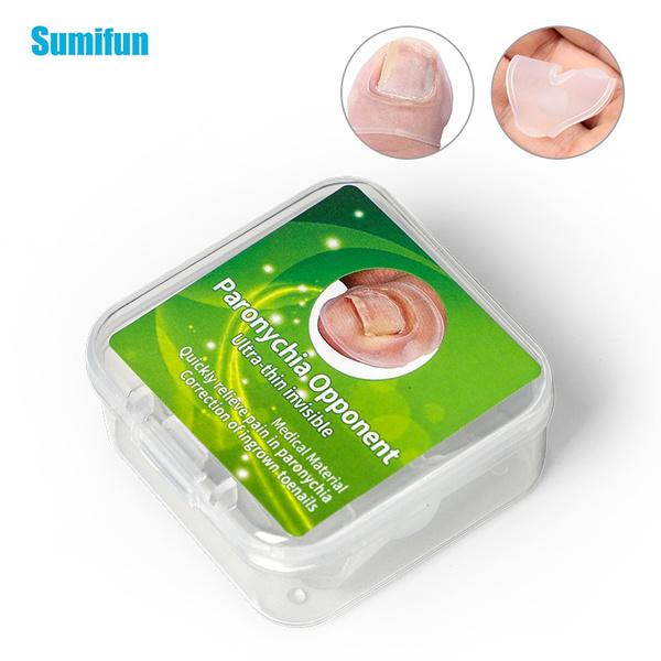 2pcs Silicone Paronychia Invisible Nail Acronyx Orthotics Patch Ingrown ...