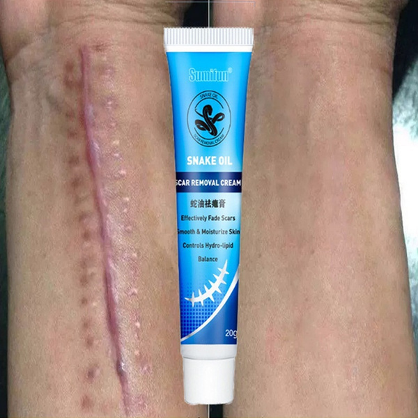 Hot 1Pcs Snake Oil Scar Cream Scar Remover Anti Scar Skin Repair Scar ...