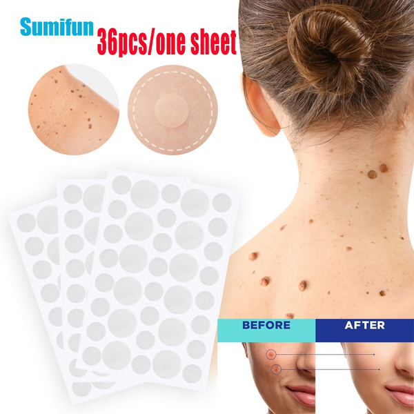 Wart Removal with 36 Stickers Wart Removal Patches Moles Set Wart Care ...